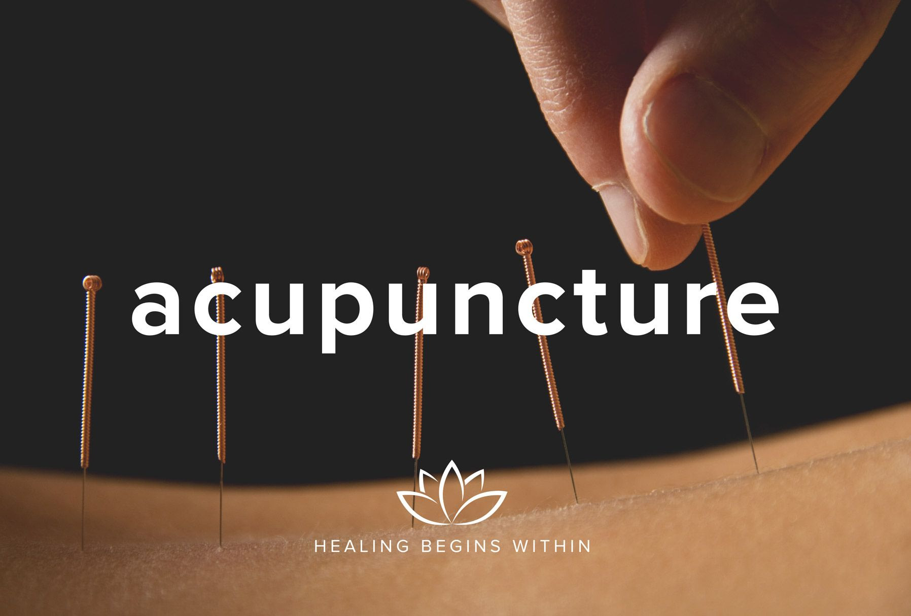 Acupuncture & Herbal Medicine
